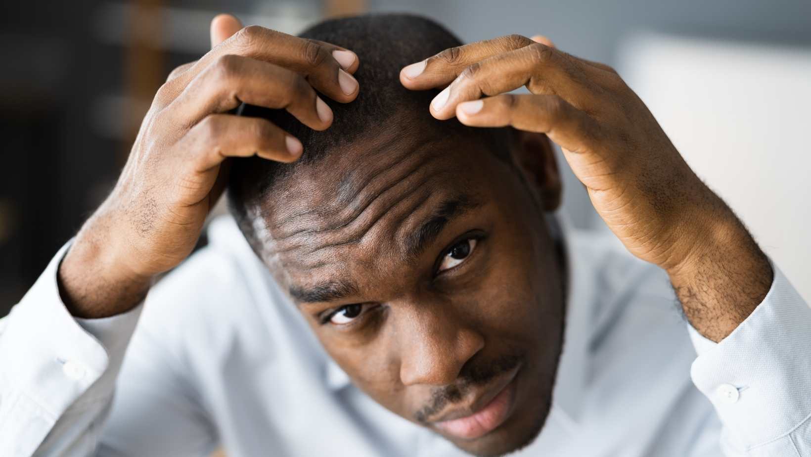 Hair Transplant Results -Timeline of Hair Growth- Turkeymed