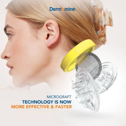 Dermomine Micrograft - Turkeymed