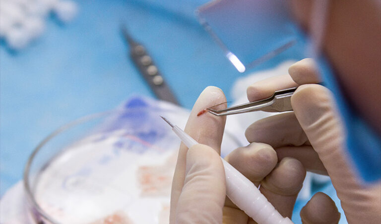 DHI Hair Transplant - Turkeymed